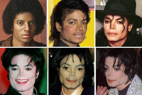 16 Pictures Showing Michael Jackson’s facial transformation - Music Raiser